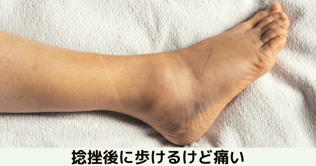 歩けるけど痛い！足首の捻挫は何日でよくなる？ 整体の操和｜沖縄県浦添市の痛みと痺れの整体院